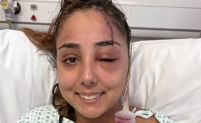 El accidente viral de esta chica: todo pasó por llevar en el coche un ...